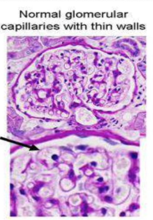 Measure capillary wall thickness - Image Analysis - Image.sc Forum