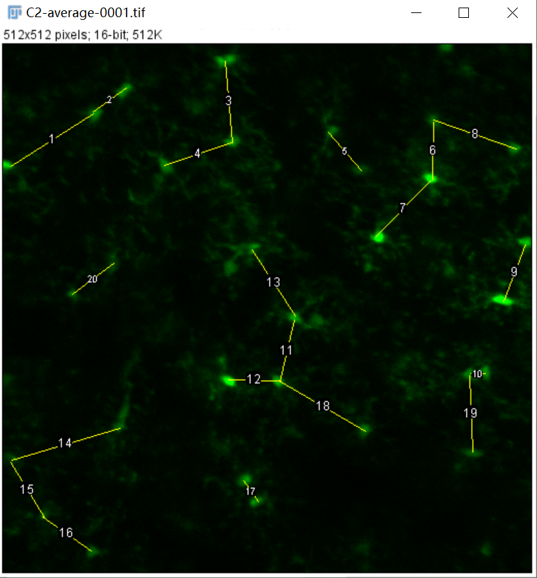 How to calculate the distance between cells？ - Image Analysis - Image ...