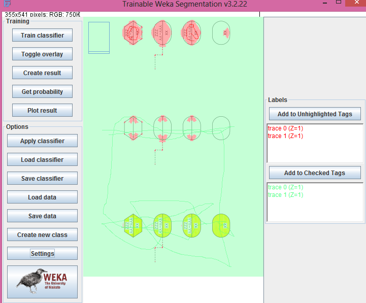 How to use trainable weka segmentation to recognise standard lines - Image Analysis - Image.sc Forum