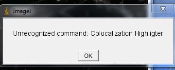 Colocalization Highligter - Image Analysis - Image.sc Forum