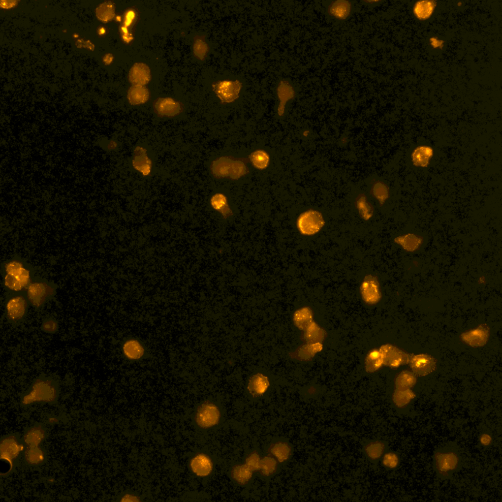 Calculating Raw Integrated Density of Thresholded Image -- Odd Results ...