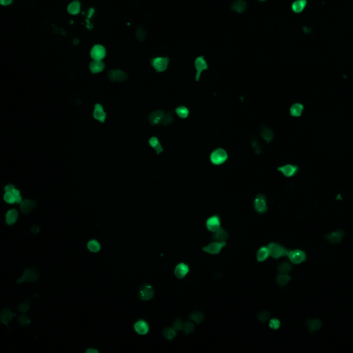 Calculating Raw Integrated Density of Thresholded Image -- Odd Results ...