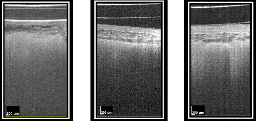 What method is best method/plugin in imageJ to standardize/compare two ...