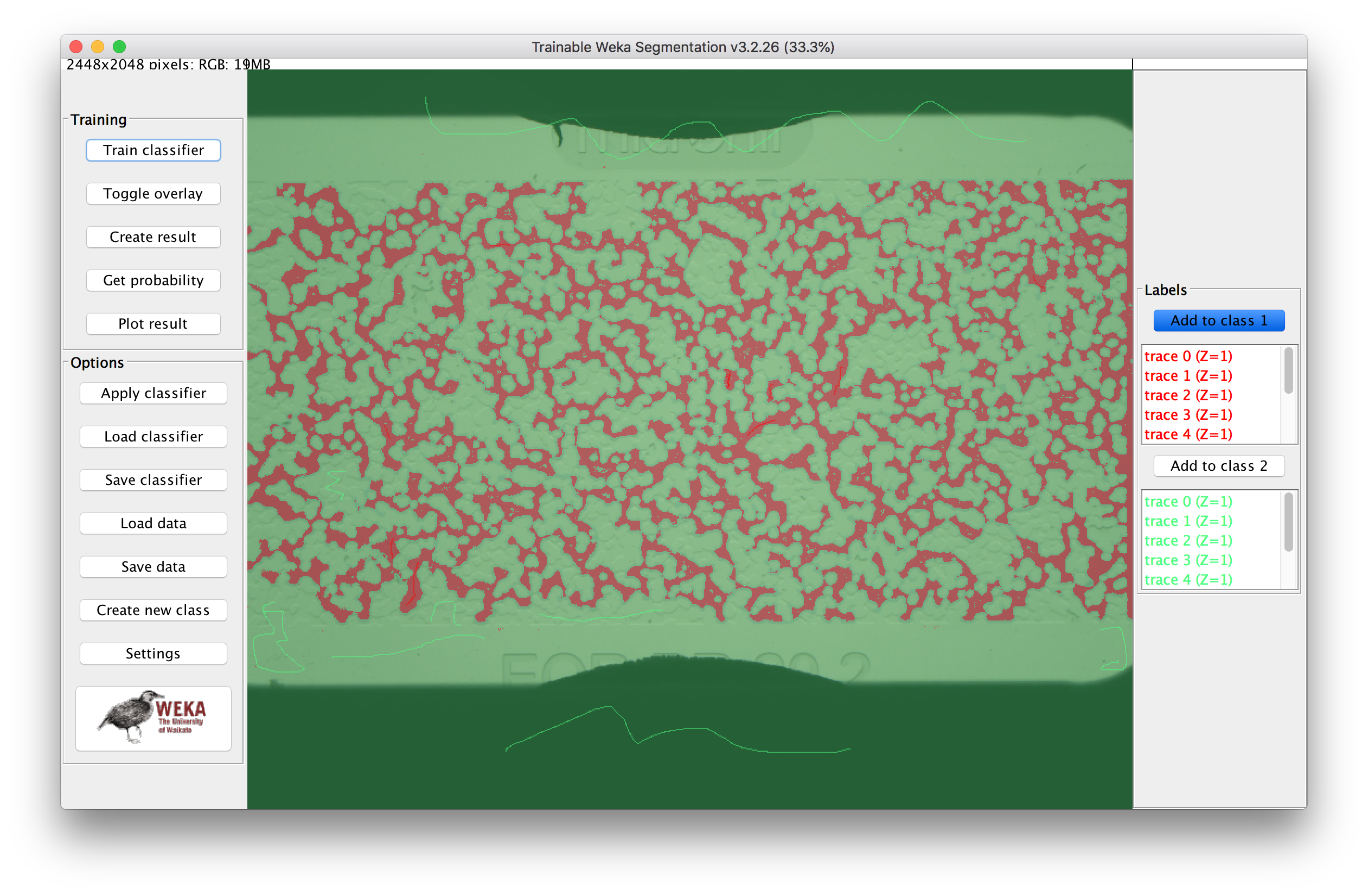 How to determine the area by ImageJ - Image Analysis - Image.sc Forum