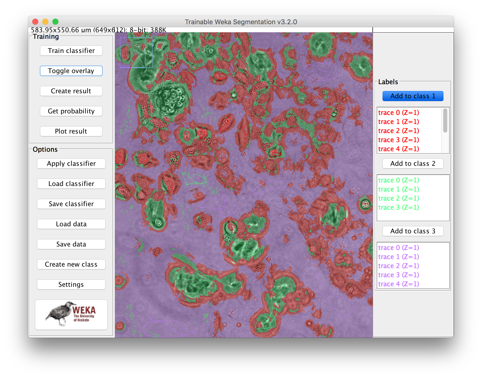Cell segmentation on bad images using weka (manual) - Image Analysis ...