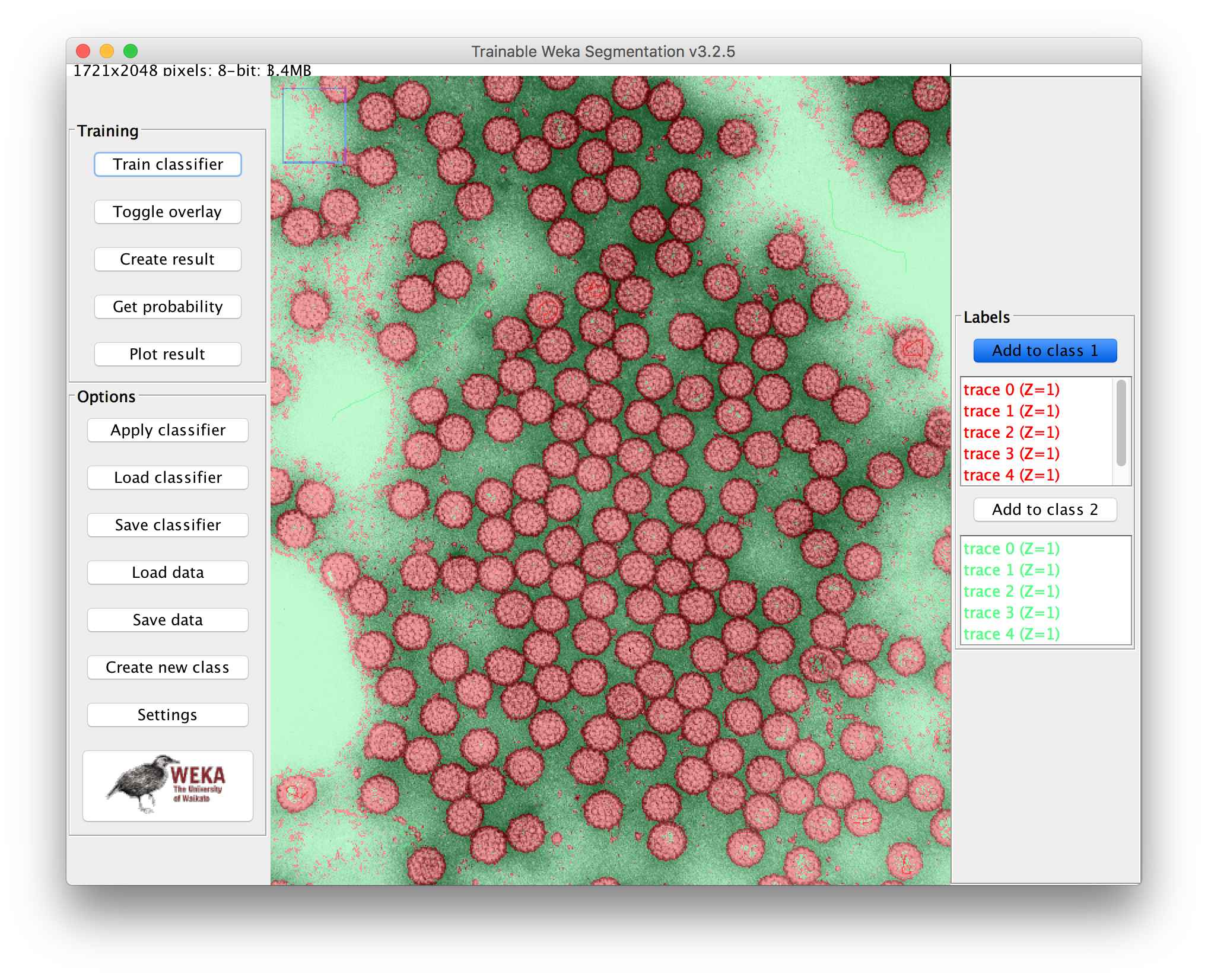 Counting the number of particles on an uneven background - Image ...