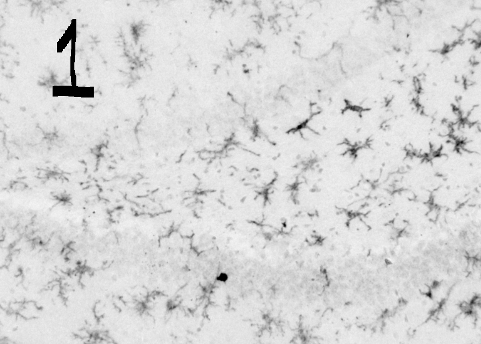 Color Threshold; Threshold color in Macro - Image Analysis - Image.sc Forum