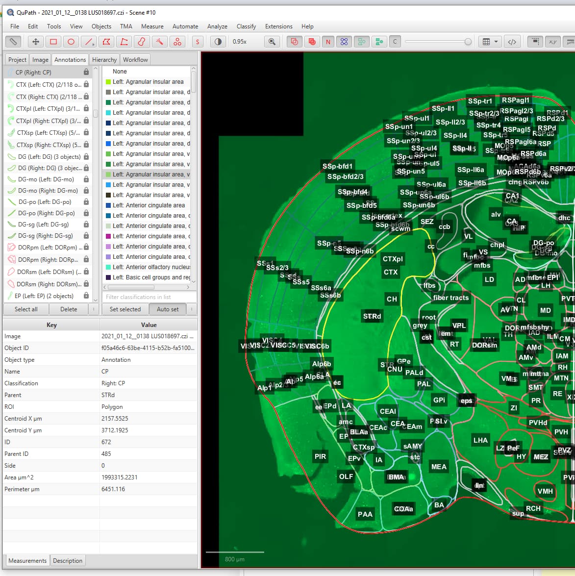 Help with ABBA annotations in QuPath - Usage & Issues - Image.sc Forum