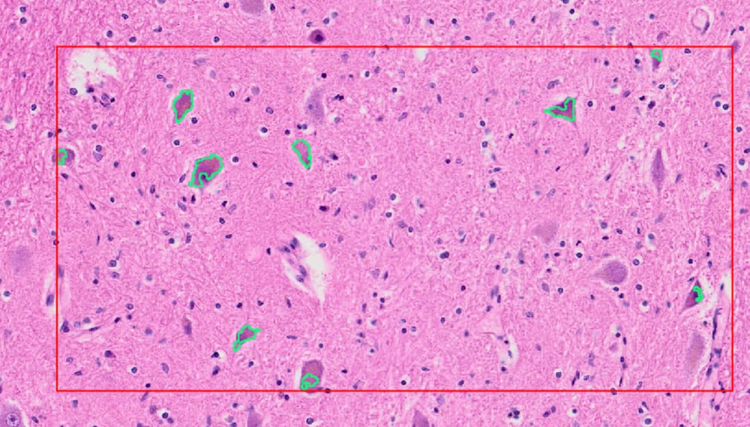 Cell Detection Using A Pixel Classifier Image Analysis Imagesc Forum