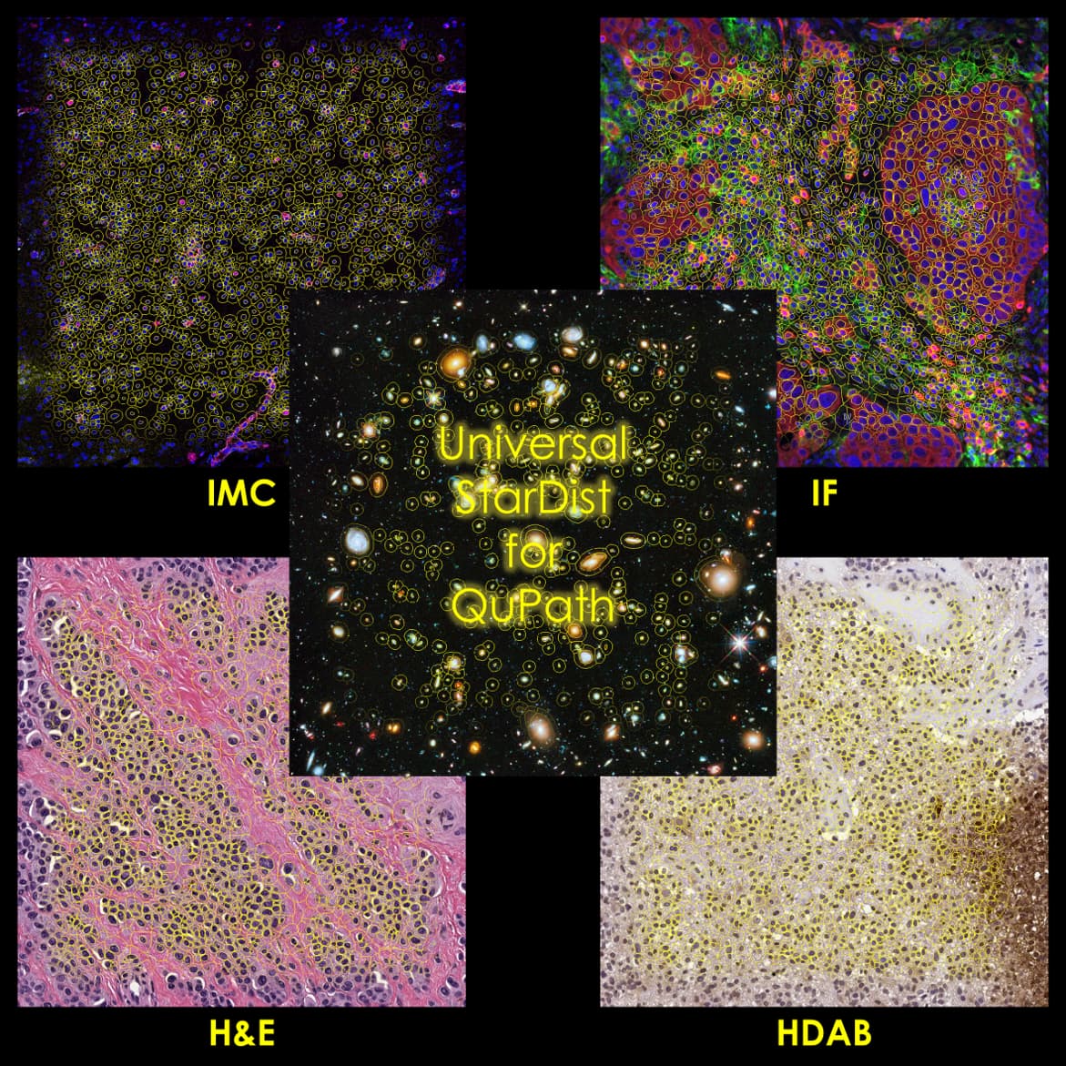 Universal StarDist for QuPath - Transfer Pretrained Models Across Modalities With Ease ...