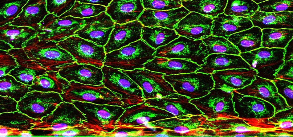 Quantification of Tight Junctions using ImageJ - Image Analysis - Image.sc Forum