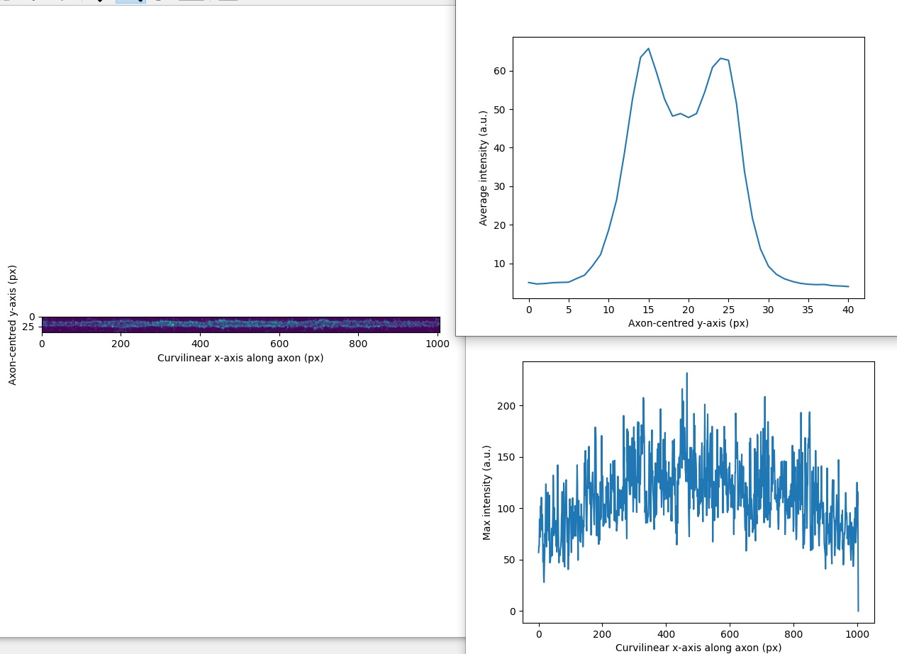ImageJ SNT: measuring intensity at the membranes across a whole axon - Image Analysis - Image.sc ...