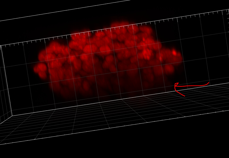 Counting nuclei of 3D organoids - Image Analysis - Image.sc Forum