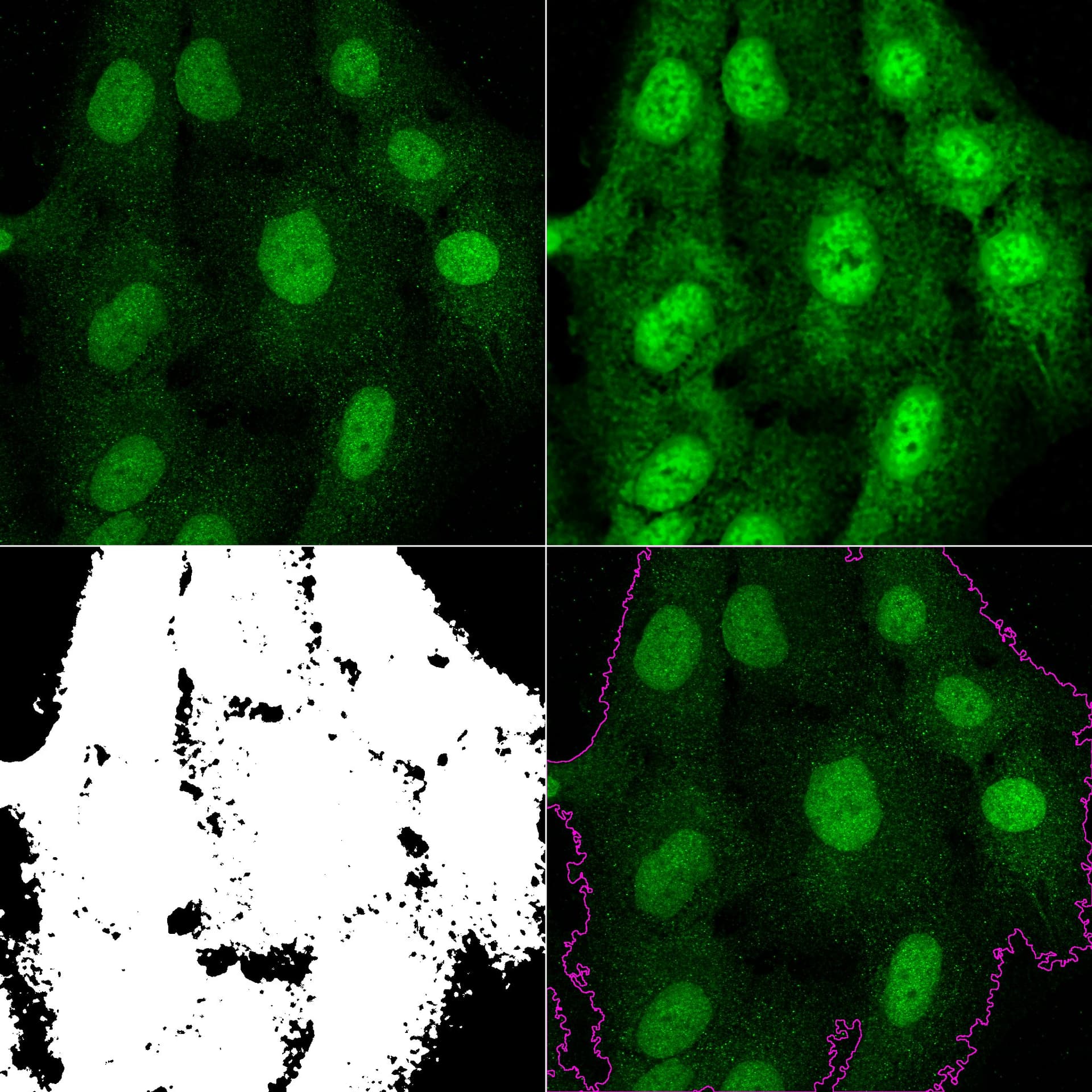 Patch processing ImageJ script for determining nucleus/cytoplasm ratio - Image Analysis - Image ...