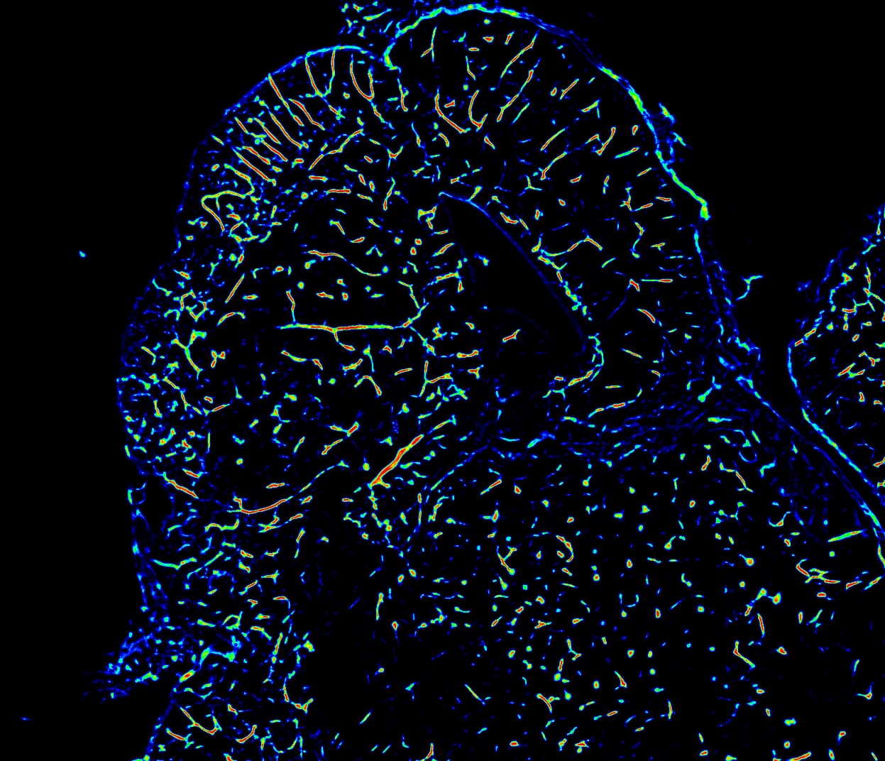 Vessel Segmentation in 3D or 2D with ML or DL - Image Analysis - Image ...