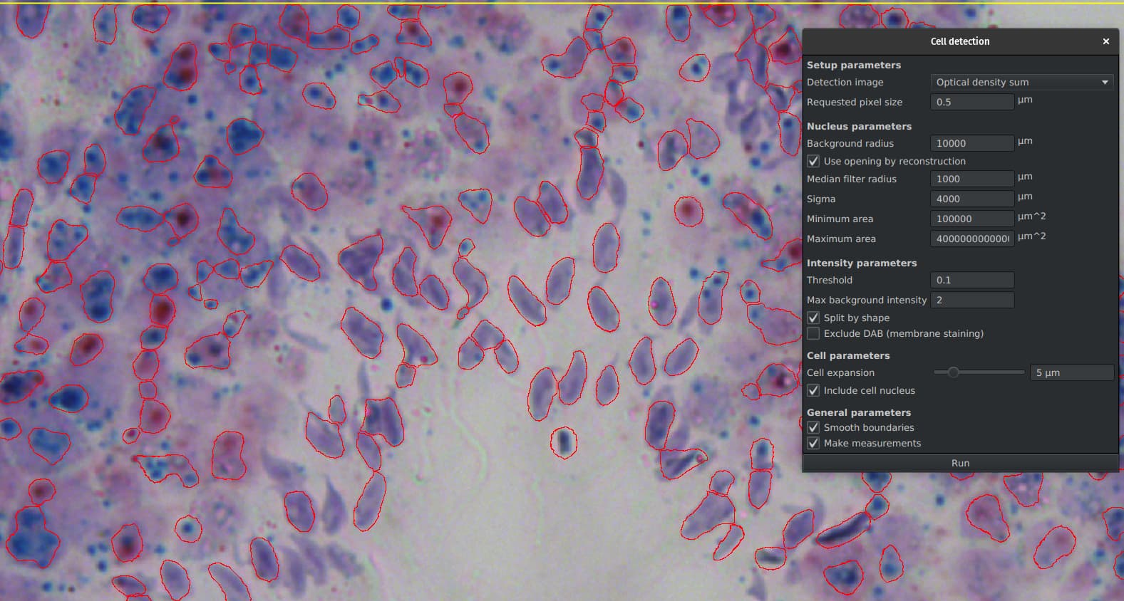 Trouble Segmenting Cells in QuPath - Image Analysis - Image.sc Forum