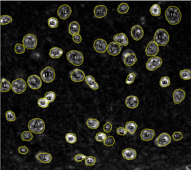 How can I count DAPI-stained cells that show multiple dots? - Image Analysis - Image.sc Forum