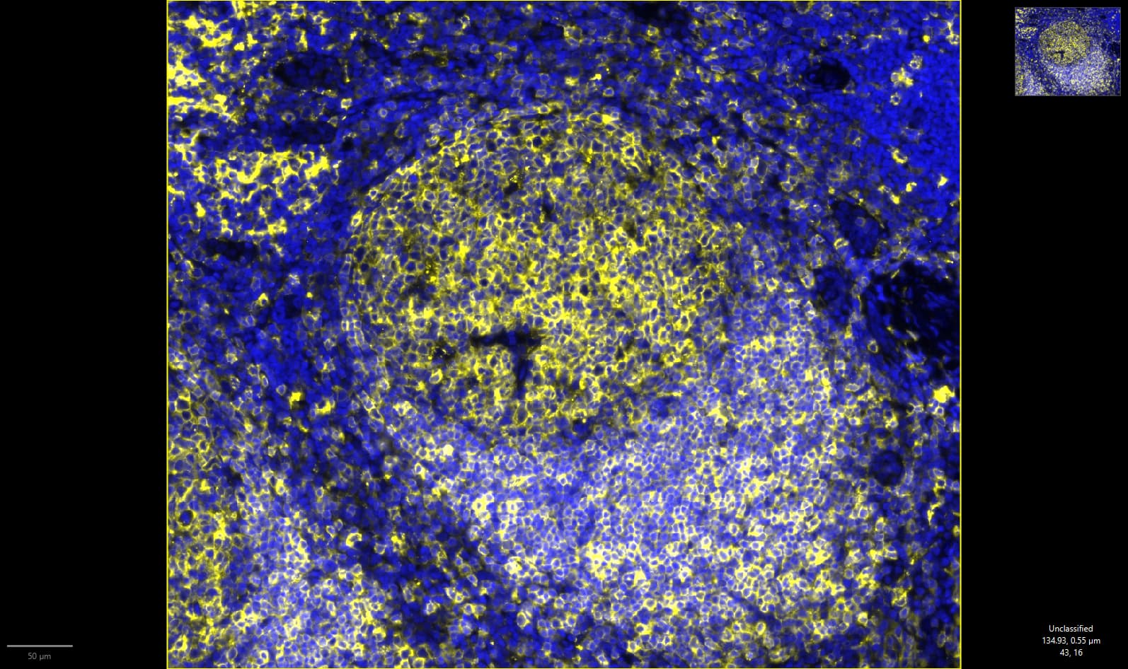 Cell detection other than DAPI on IF - Image Analysis - Image.sc Forum