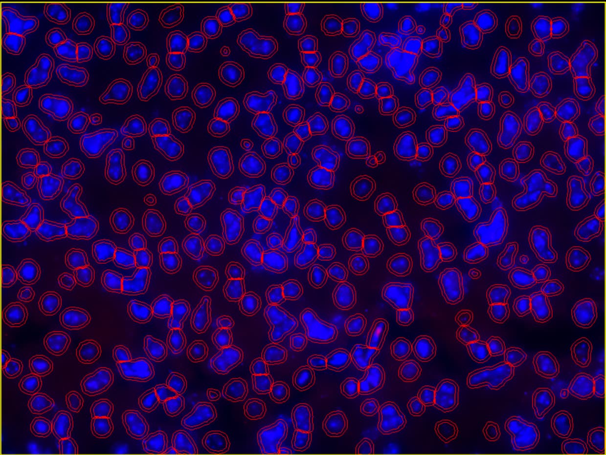 Cell detection in qupath not working across samples - Image Analysis - Image.sc Forum
