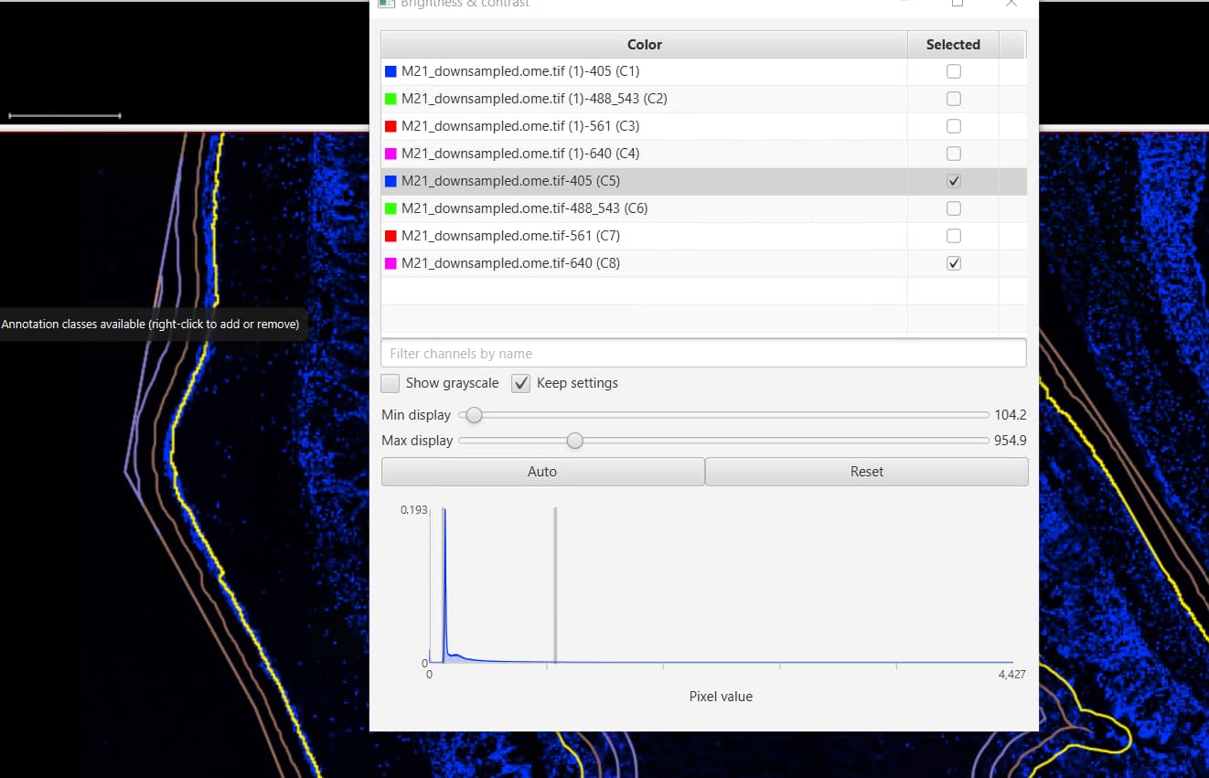 Qupath ImageCombiner alignment apply the affine transform to the image - Usage & Issues - Image ...