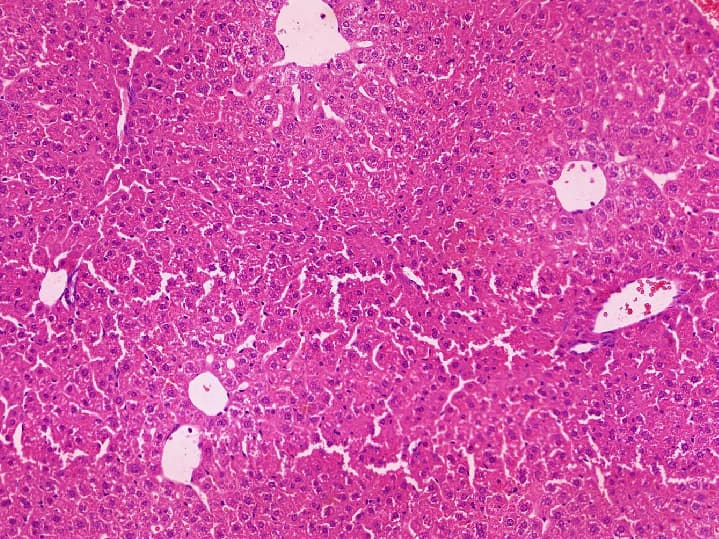 How to find the Tumour Nodules and lesion int he H&E staining image using Qupath software ...