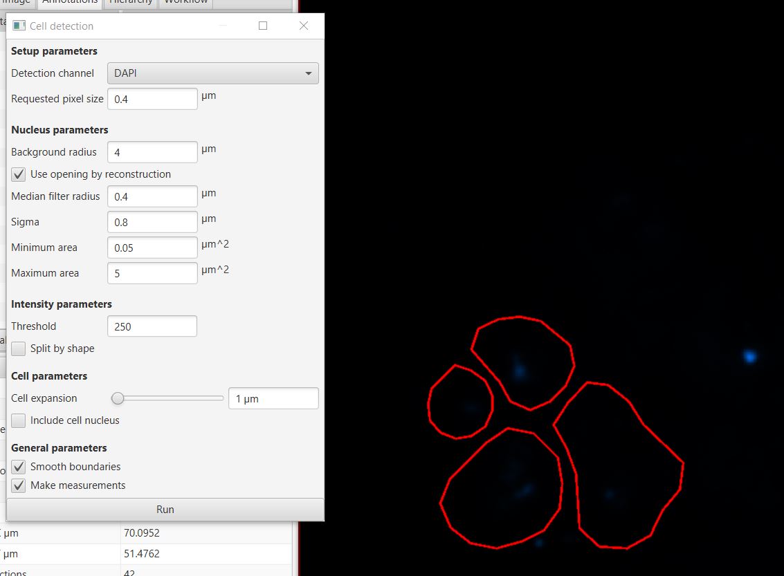 Cell detection issues in Qupath - Image Analysis - Image.sc Forum
