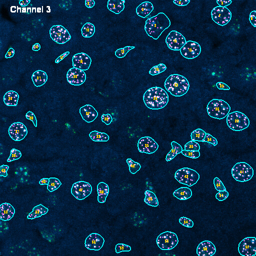 3D Image Preprocessing and Nuclear Segmentation - Image Analysis - Image.sc Forum