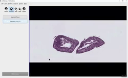 NoCodeSeg: Deep learning based segmentation without code (Qupath/DeepMIB/FastPathology) - Image ...