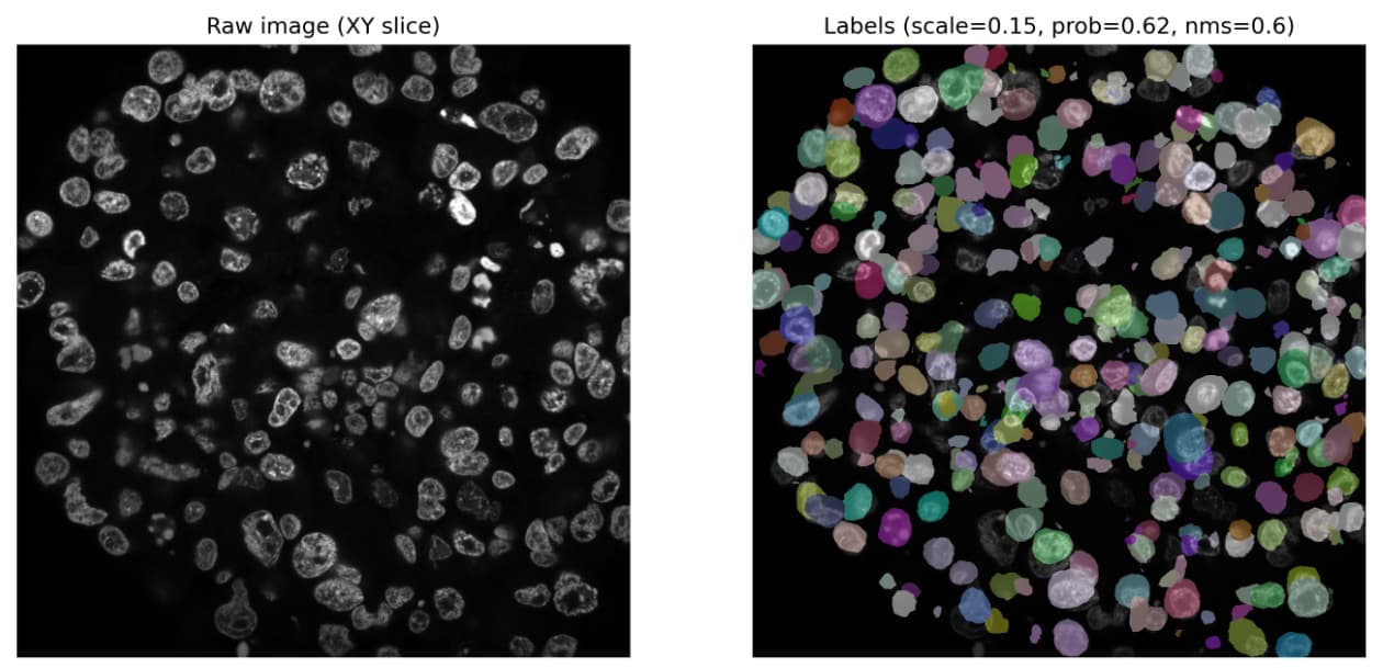 Using StarDist 3D Demo Model for Embryo Nucleus Segmentation ...