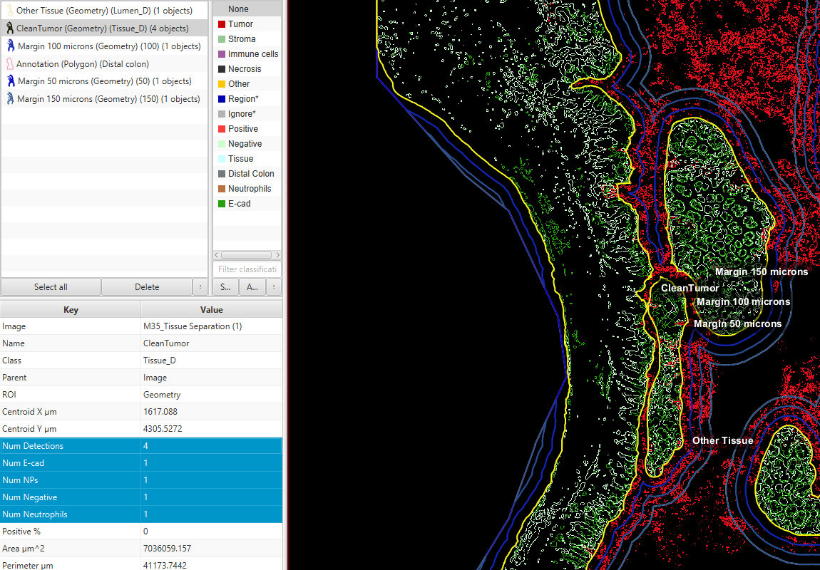 Issue with pixel classifier and create detection objects in QuPath v3.2 - Image Analysis - Image ...