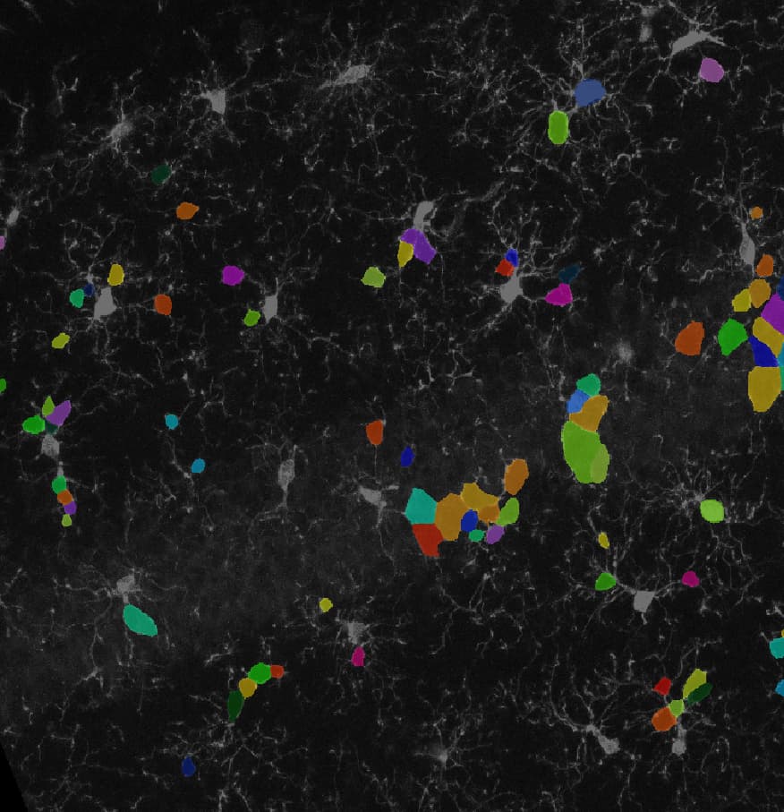 Cellpose 4.0.6 + CPSAM - unexpected(?) behavior on 1-channel MIP confocal of stellate cells ...