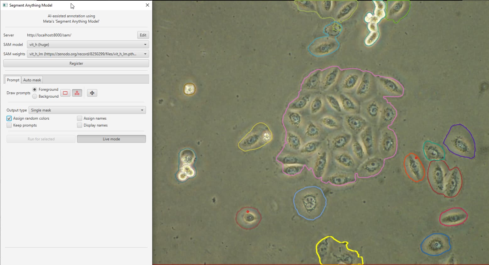 Improving samapi segmentation in QuPath - Usage & Issues - Image.sc Forum