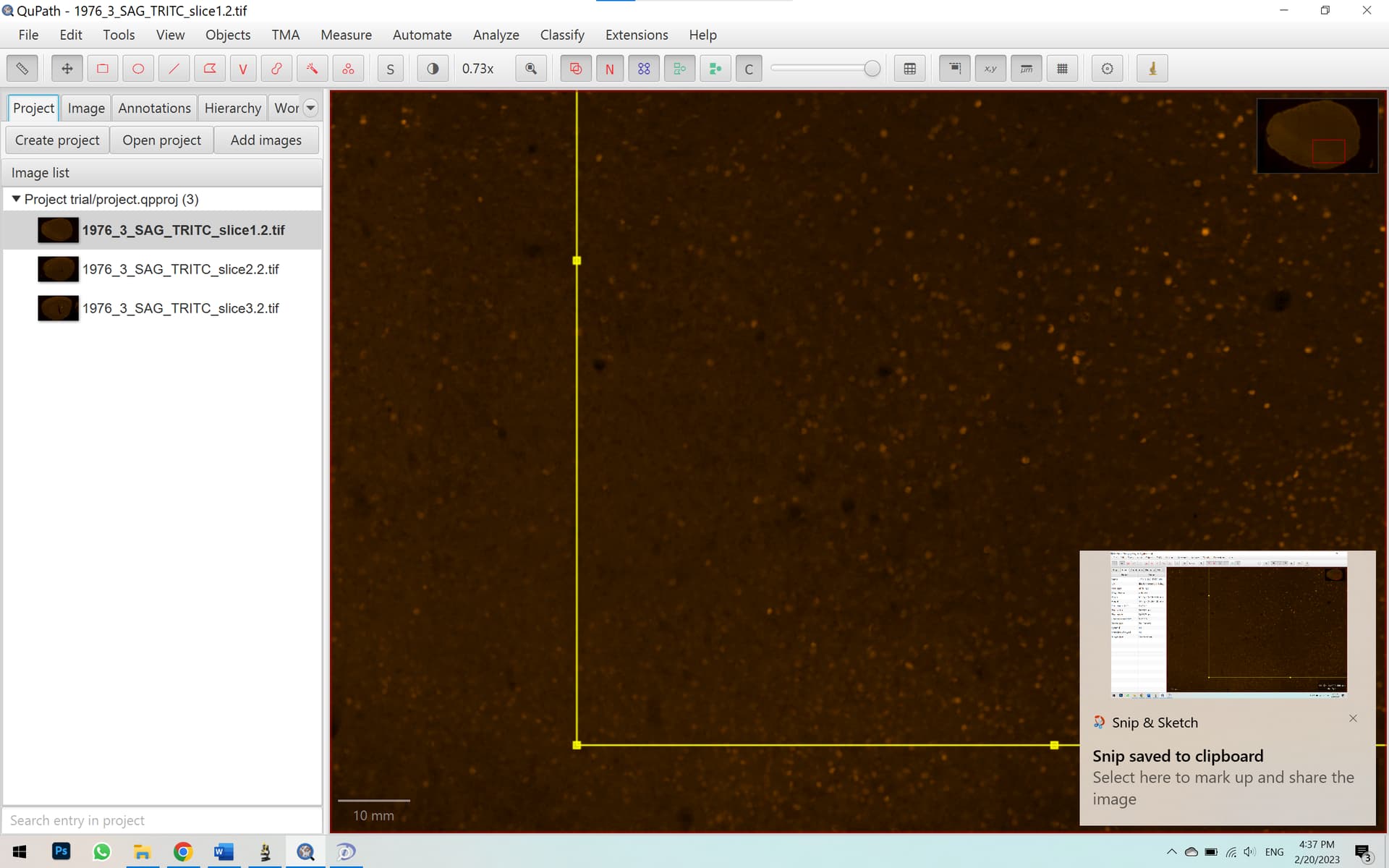 Analyze cFos marker in QuPath - Image Analysis - Image.sc Forum