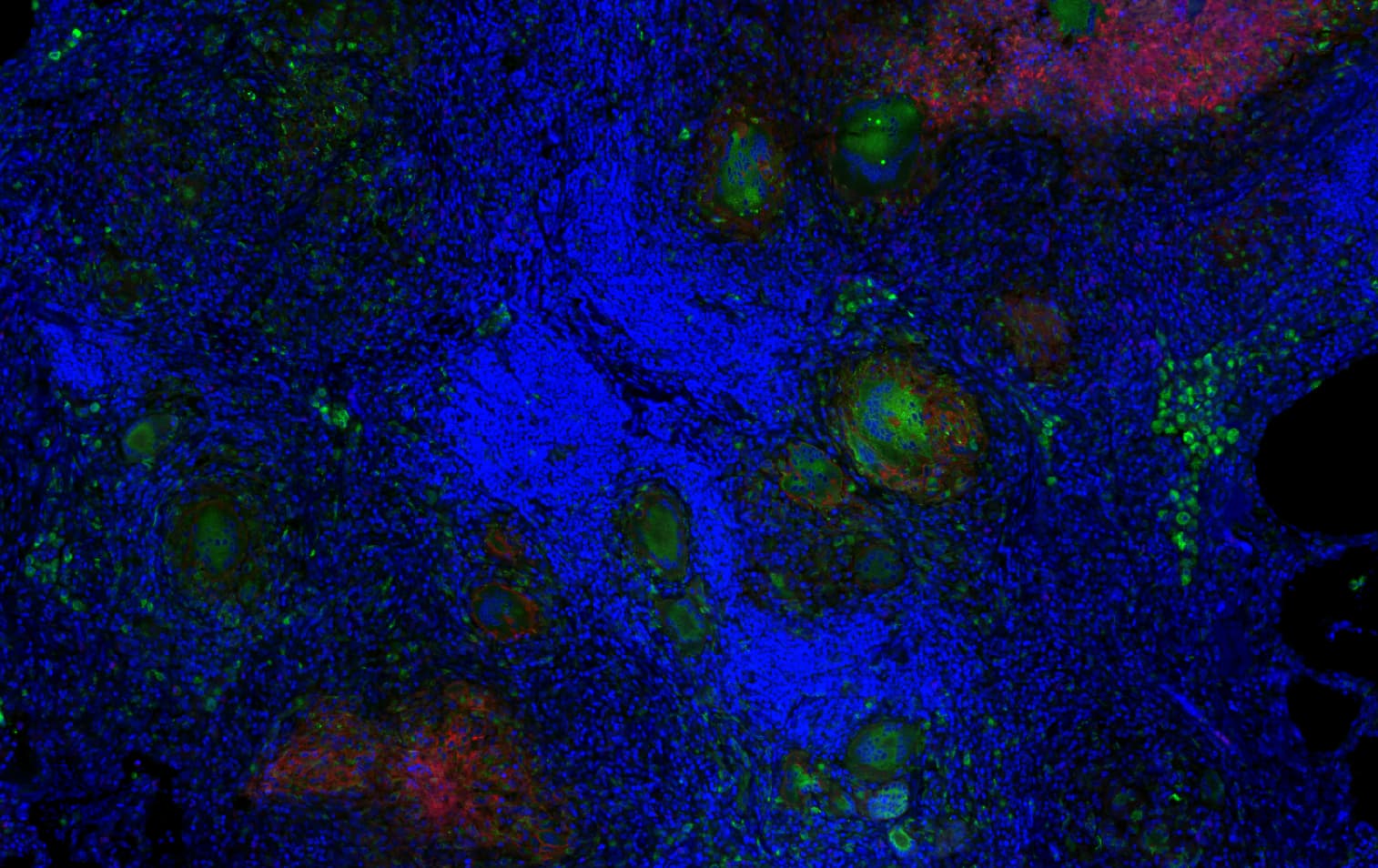MGCs segmentation using Meta Segment Anything Model - Image Analysis ...
