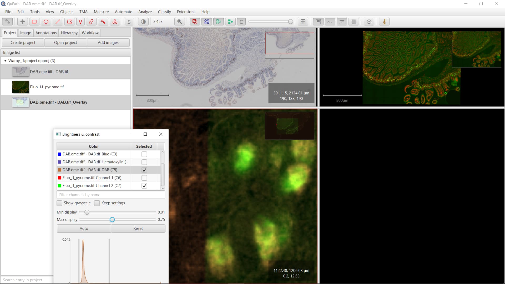 ImageCombinerWarpy – Overlaying registered images in QuPath - Announcements - Image.sc Forum