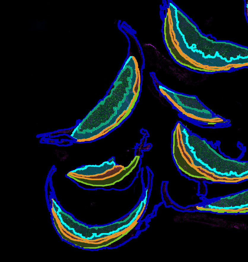 Resolve Hierarchy In Qupath Taking Hours Image Analysis Imagesc Forum