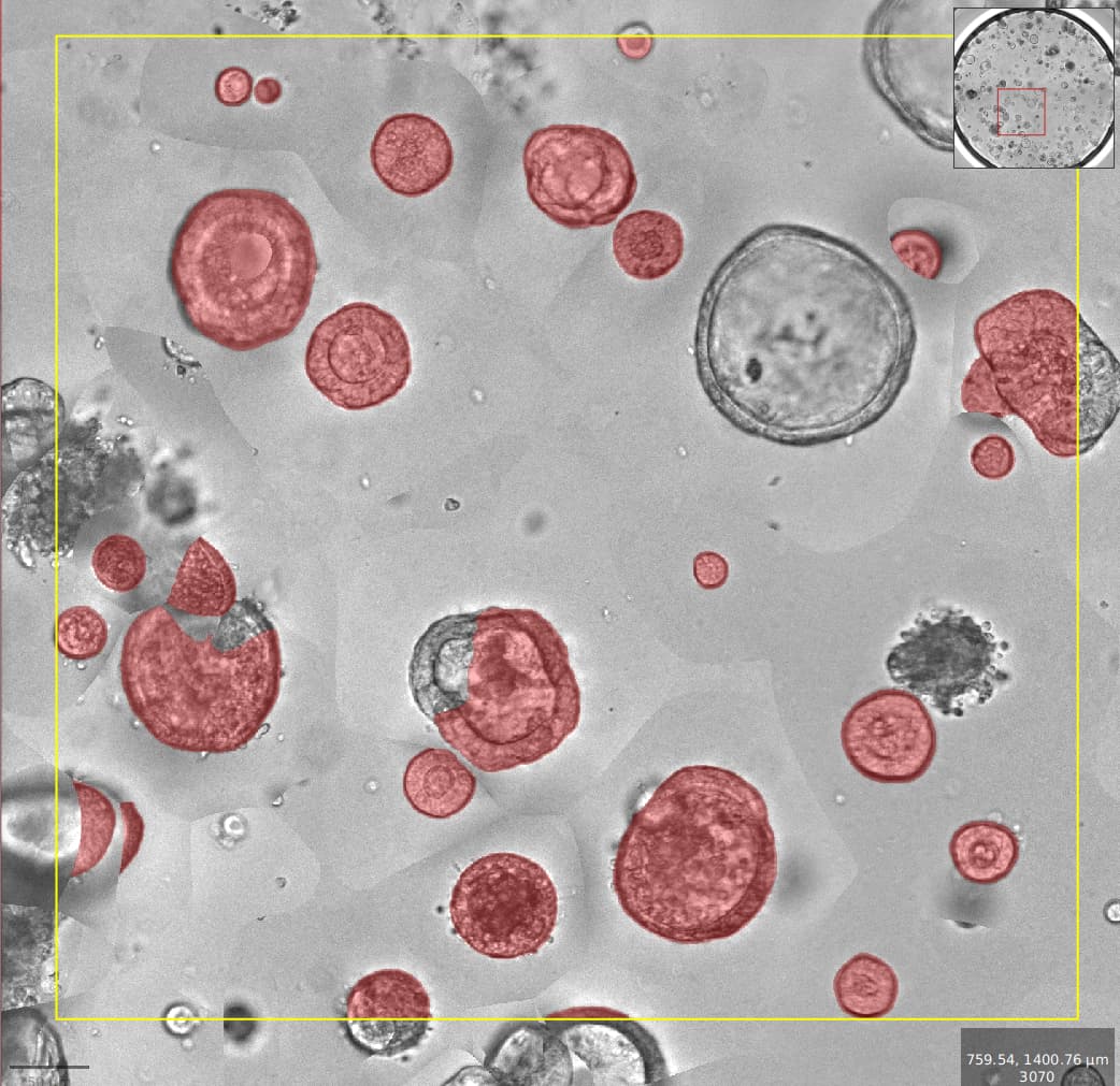 Cellpose-SAM - QuPath extension - Usage & Issues - Image.sc Forum