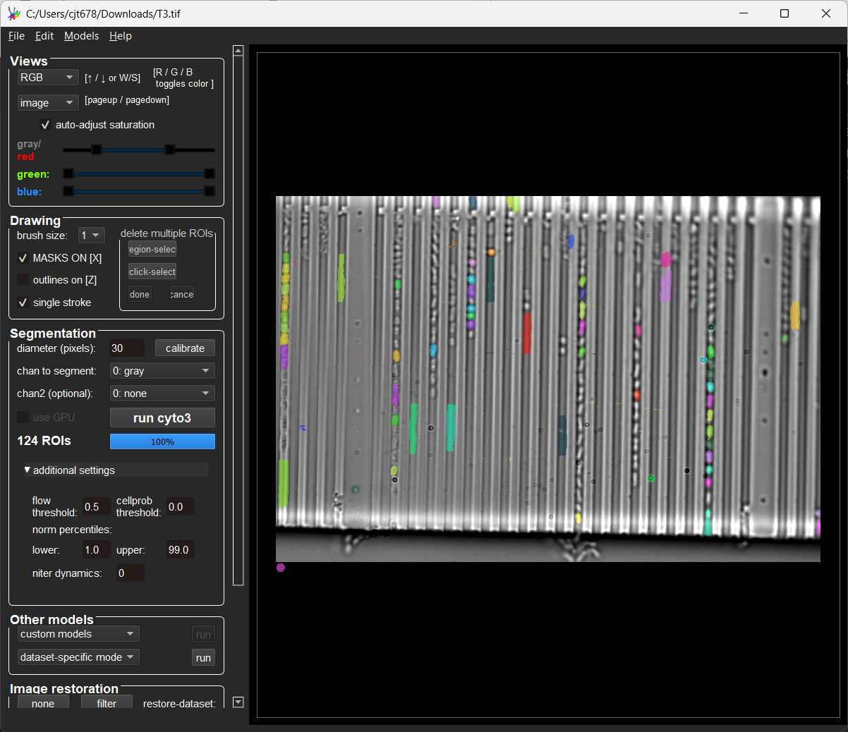 I would like to run a WEKA segmentation in ImageJ for bacterial cells ...
