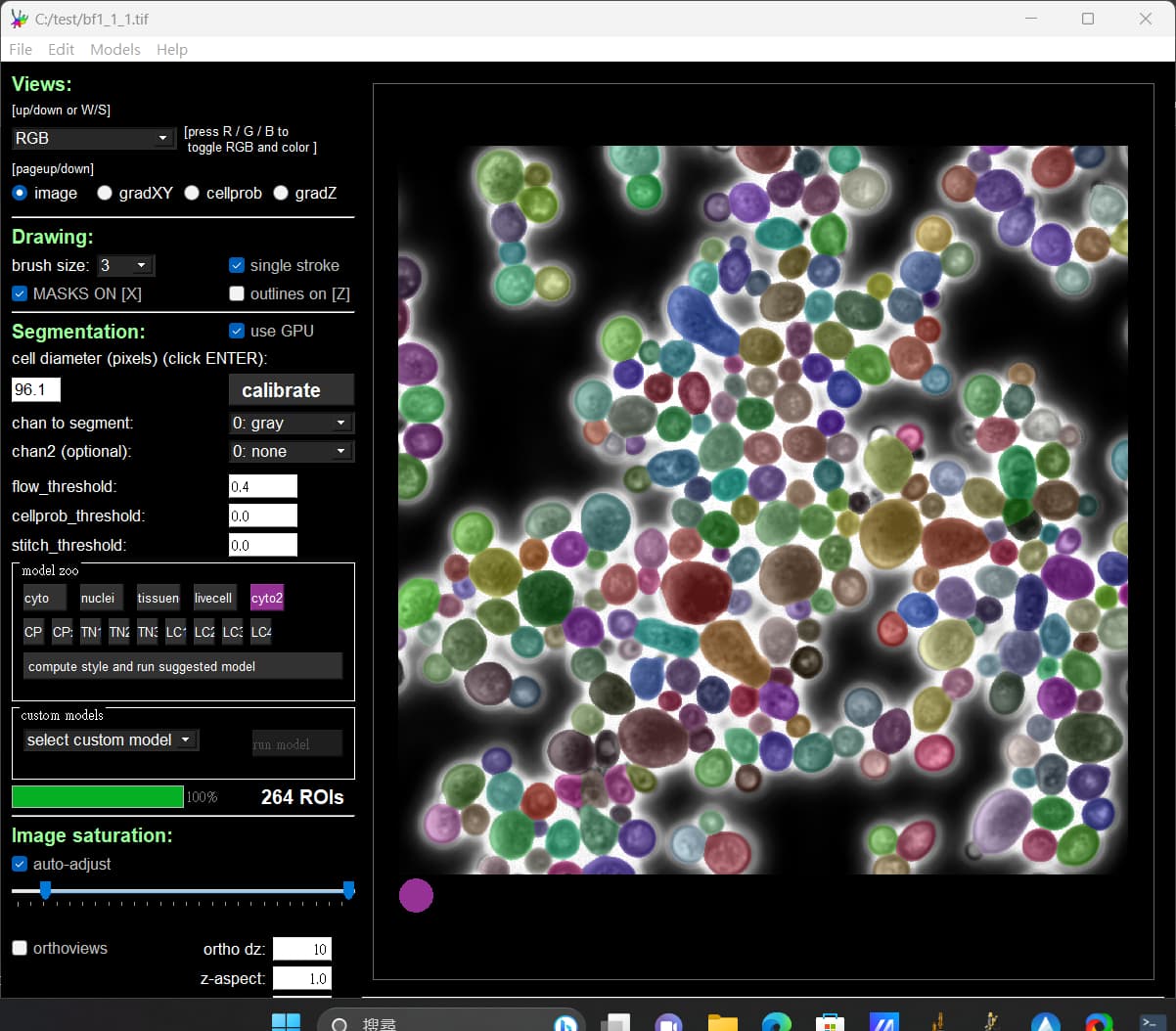 Selection of Yeast cells - Image Analysis - Image.sc Forum