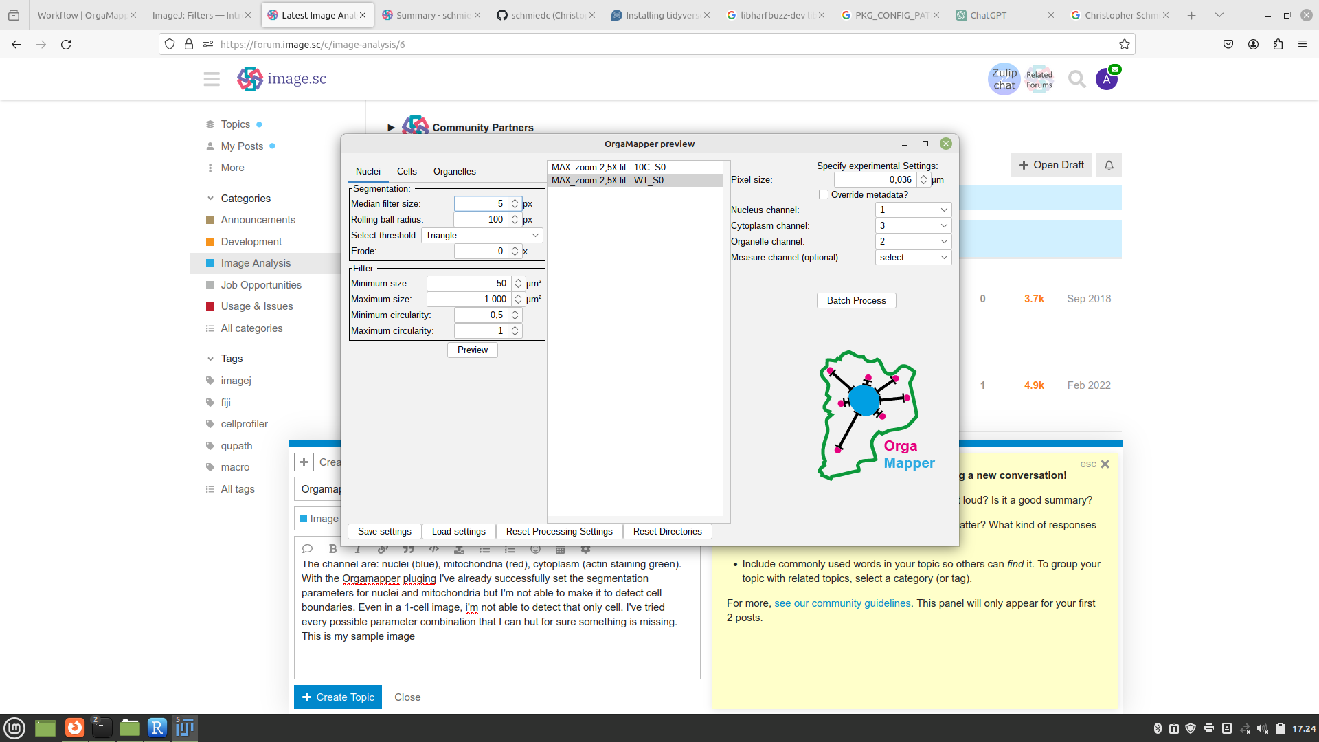 Orgamapper segmentation for cells - SOLVED - Image Analysis - Image.sc Forum