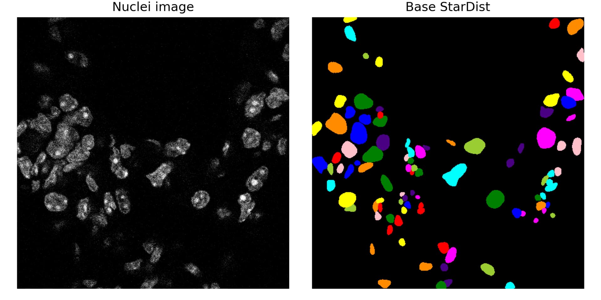 Help with Nuclear segmentation of Mouse lungs Using Fiji/CellProfiler - Image Analysis - Image ...