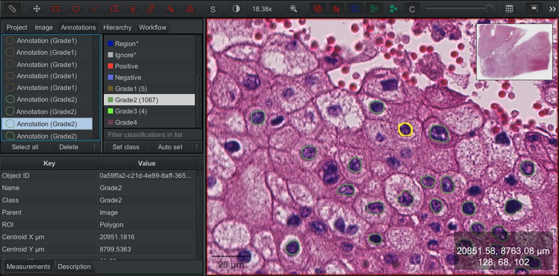 Exporting QuPath Annotation - Usage & Issues - Image.sc Forum