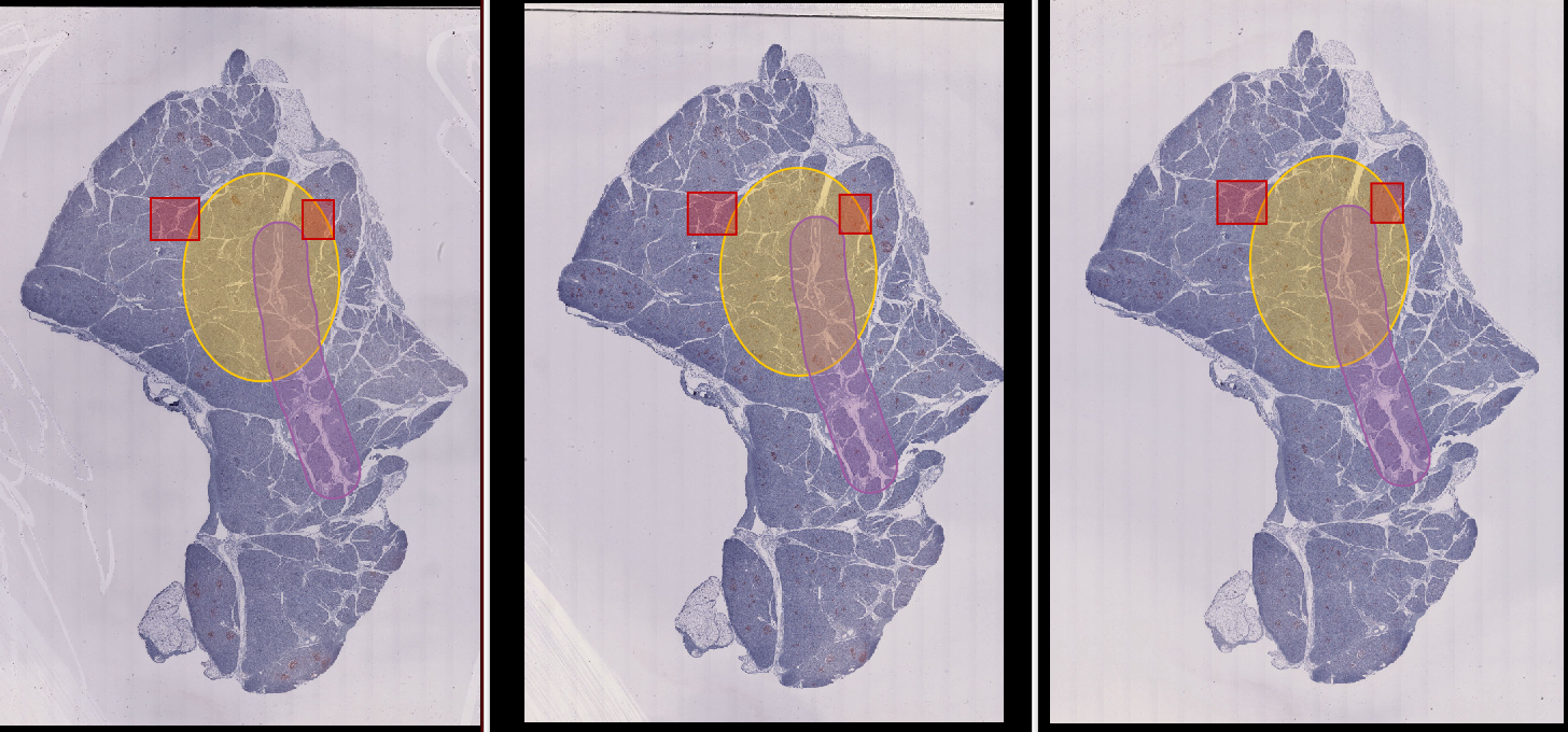 QuPath- Multiple Image Alignment and Object Transfer - Image Analysis ...