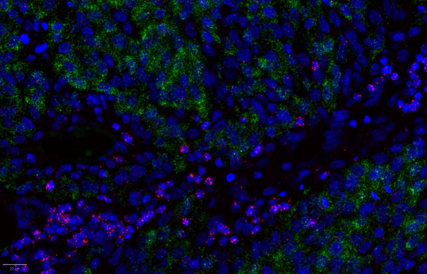 RNAscope subcellular detection threshold - Image Analysis - Image.sc Forum