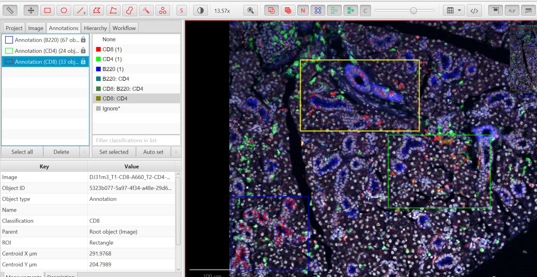 Changing color of detections of multiple cell/stain types - Image Analysis - Image.sc Forum