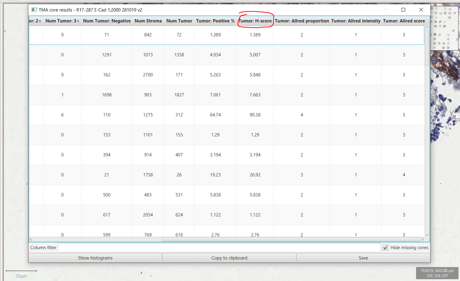 How do I get a separate H-Score for Cytoplasm and Nuclear staining ...