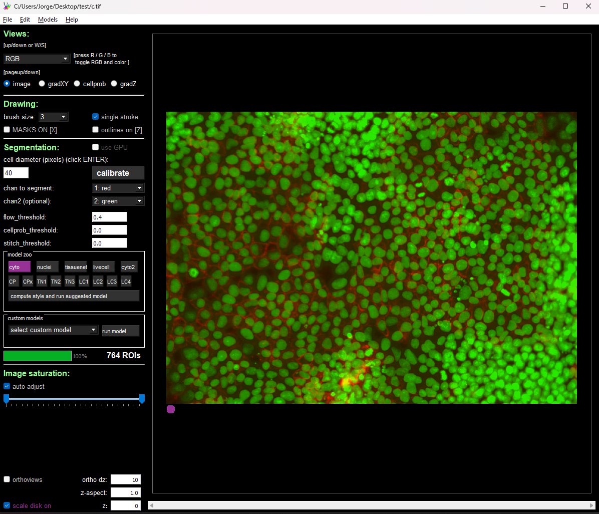 Fluorescence and cell quantification and segmentation from a membrane marker - Image Analysis ...