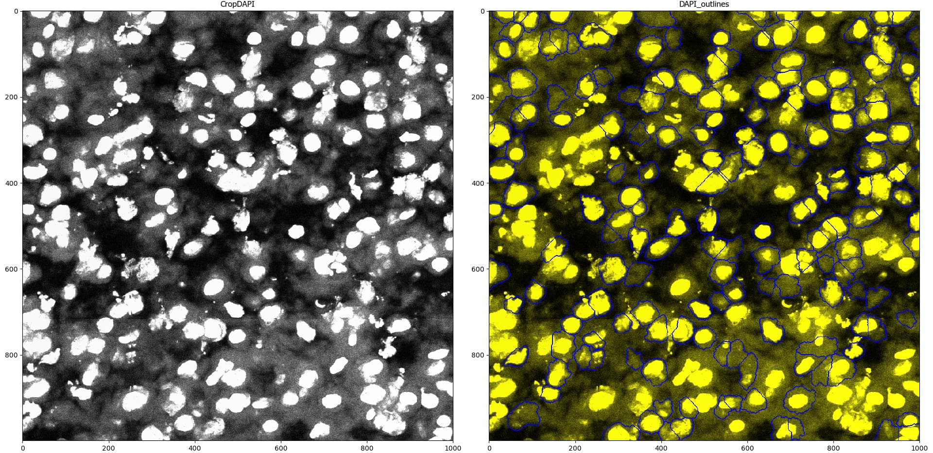 CellProfiler: How to subtract background from DAPI stained image to improve nuclei ...