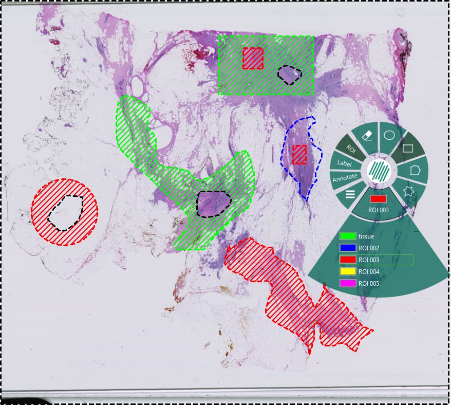 Python script to migrate Visiopharm ROI annotations to QuPath - Development - Image.sc Forum