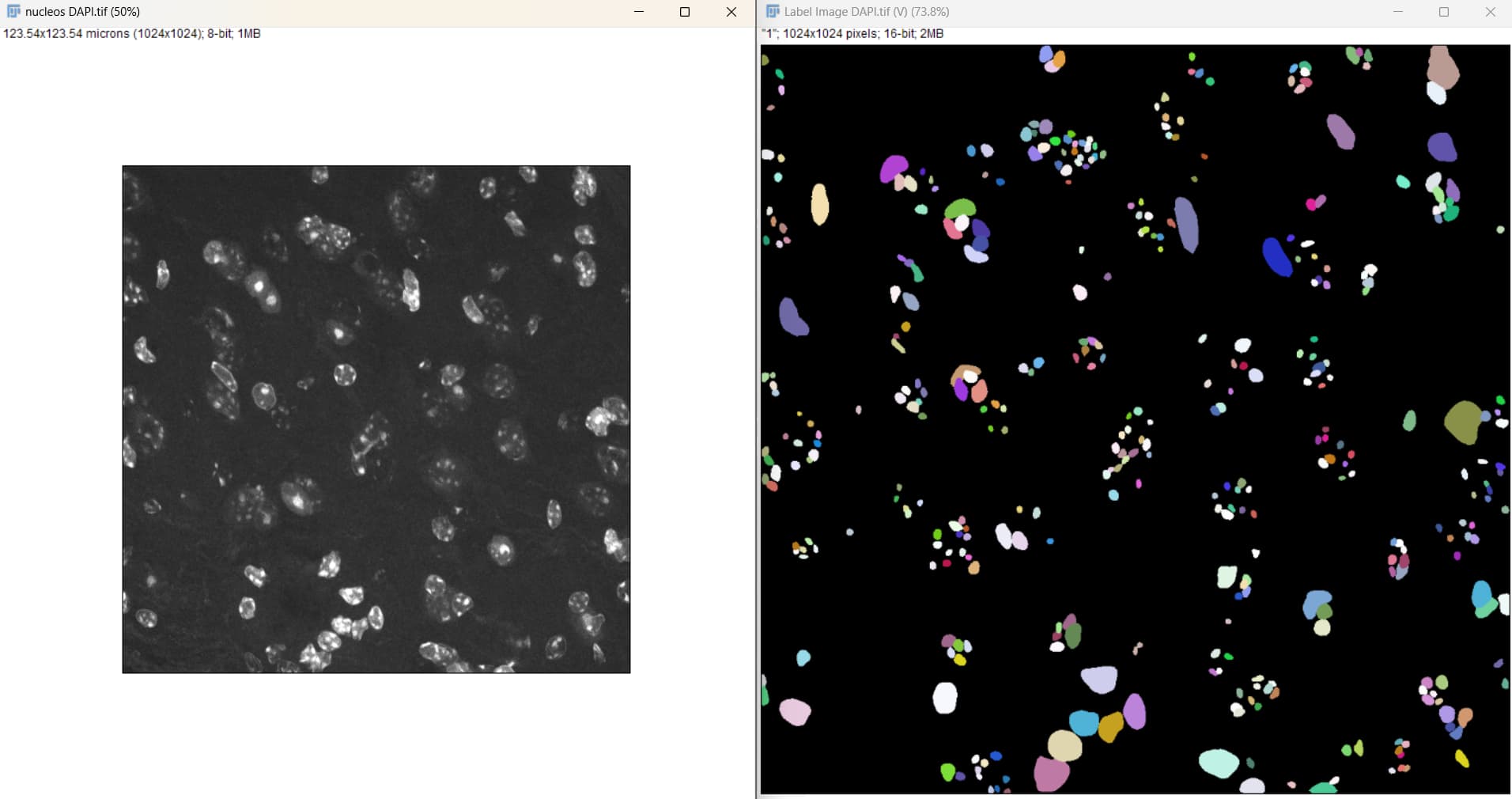 How can I count DAPI-stained cells that show multiple dots? - Image Analysis - Image.sc Forum